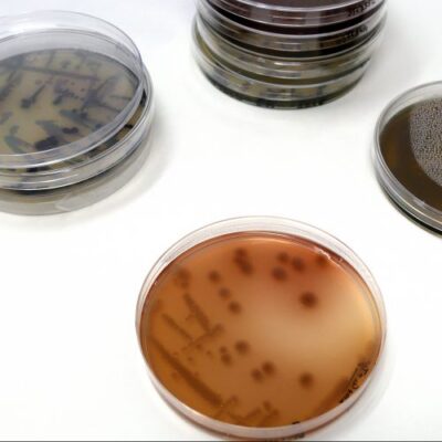 Dyeing clothes with genetically engineered bacteria - MaterialDistrict